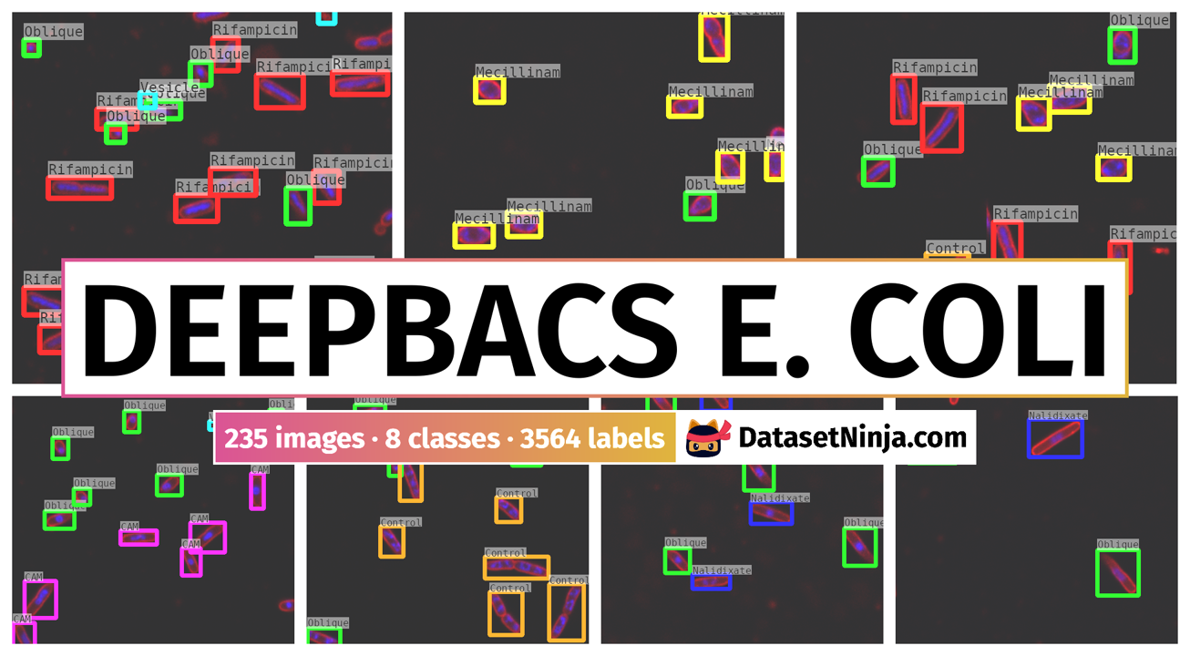 DeepBacs E. Coli - Dataset Ninja
