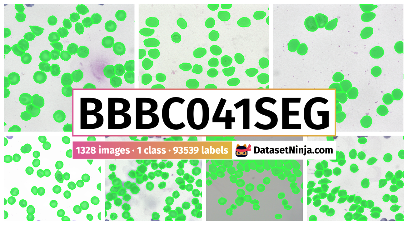 BBBC041Seg - Dataset Ninja