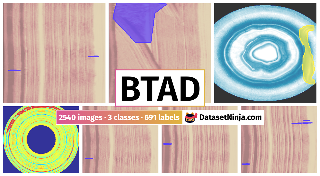 BTAD - Dataset Ninja