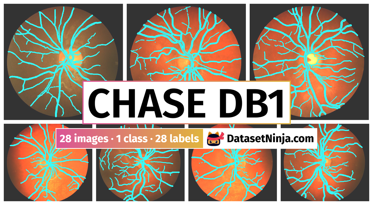 CHASE DB1 - Dataset Ninja