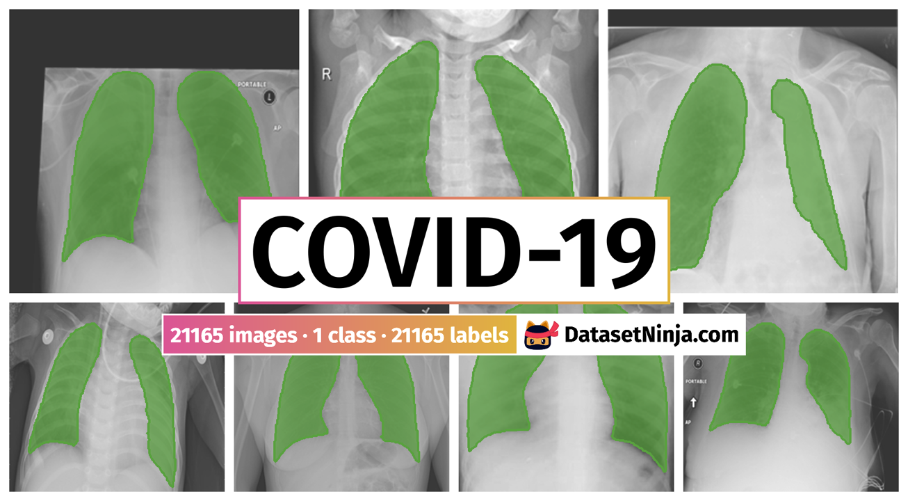 COVID-19 - Dataset Ninja COVID-19 - Dataset Ninja