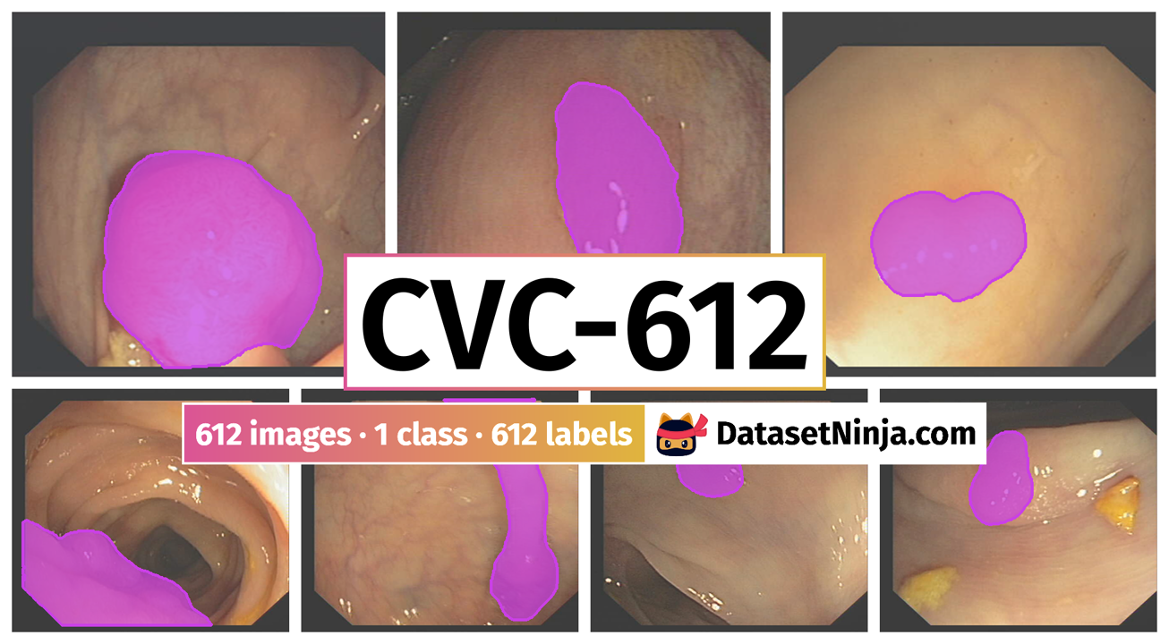 CVC-ClinicDB - Dataset Ninja