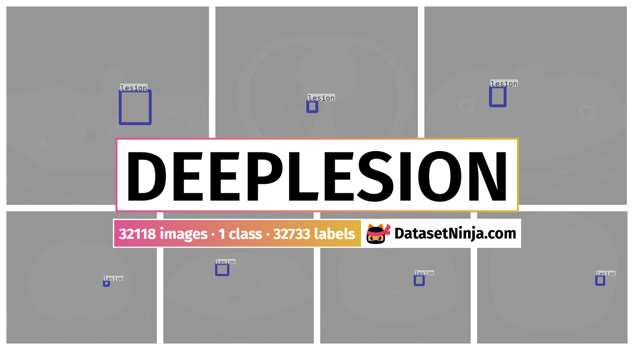DeepLesion - Dataset Ninja