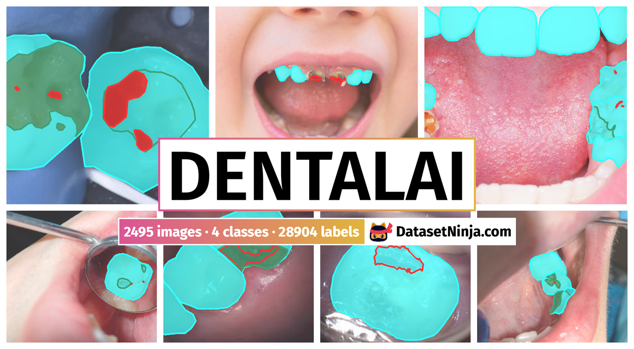 Dentalai Dataset Ninja
