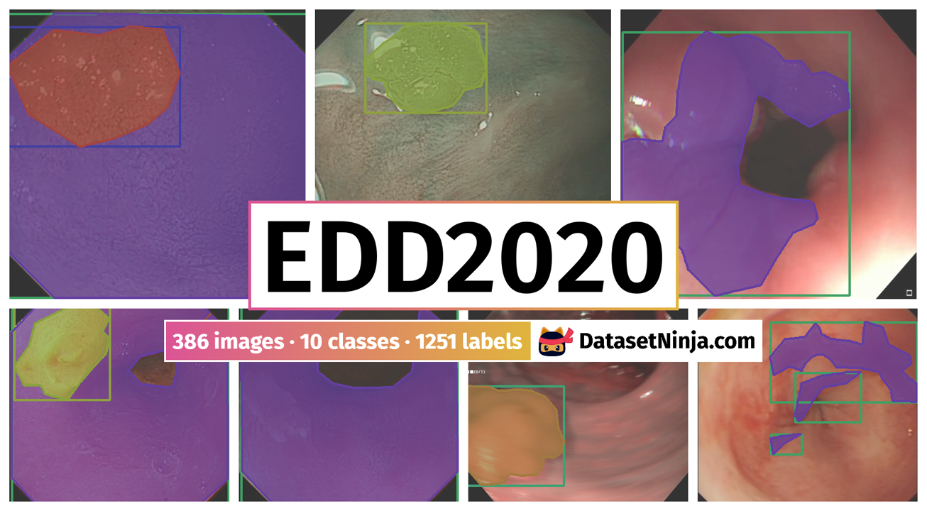 Edd2020 Dataset Ninja