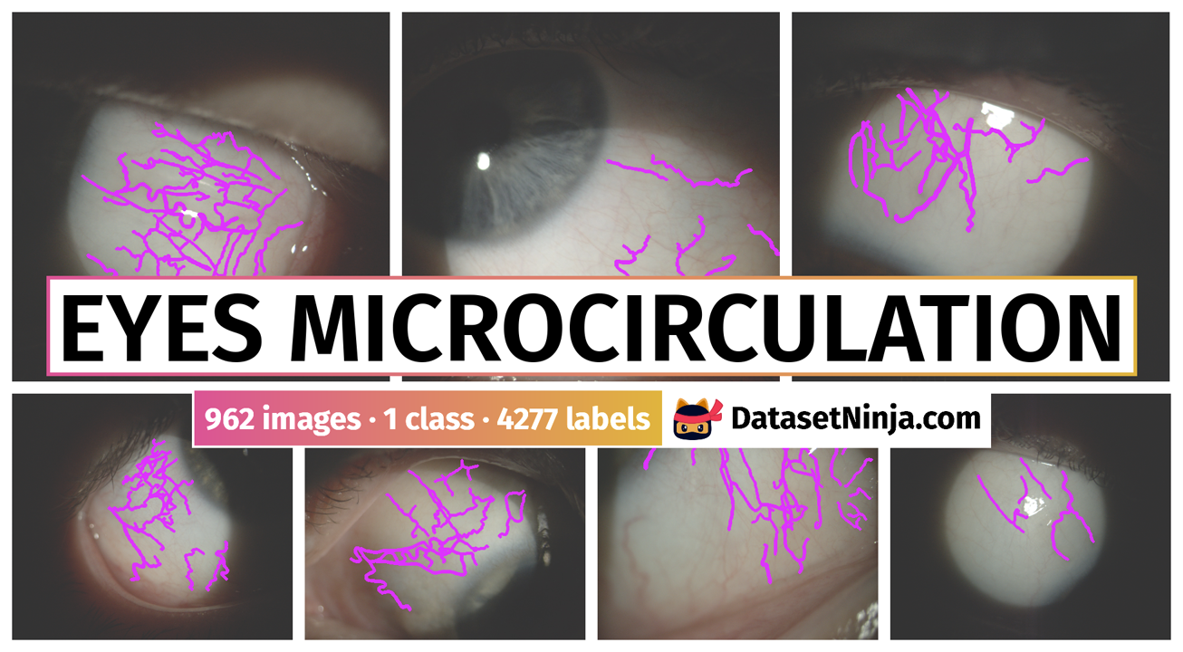 Eyes Microcirculation - Dataset Ninja