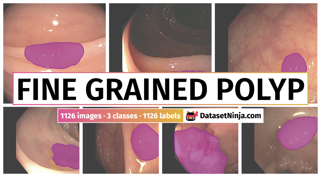 Fine Grained Polyp - Dataset Ninja