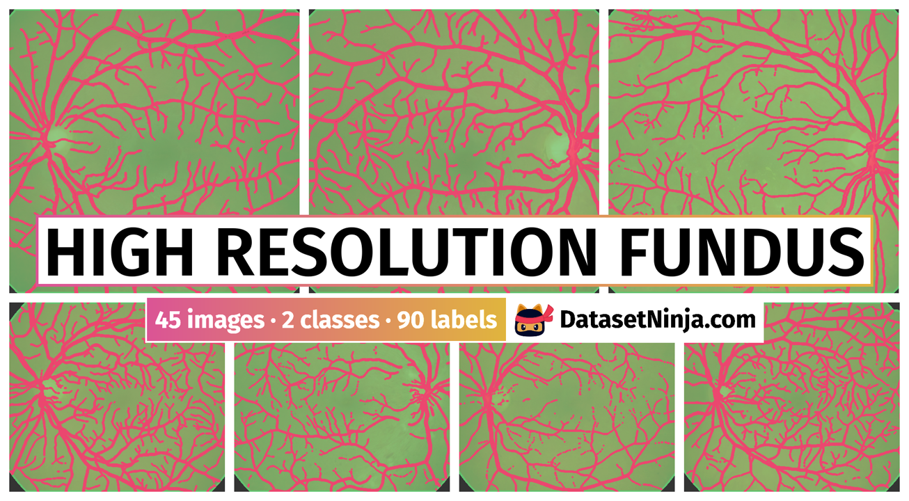 High Resolution Fundus Dataset Ninja