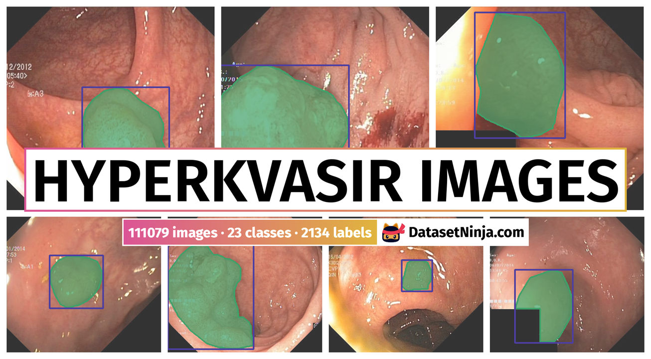 HyperKvasir Images - Dataset Ninja