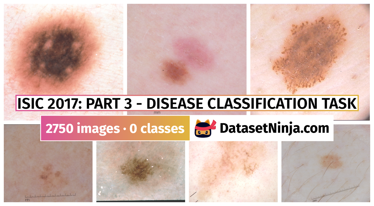 ISIC 2017: Part 3 - Disease Classification Task - Dataset Ninja