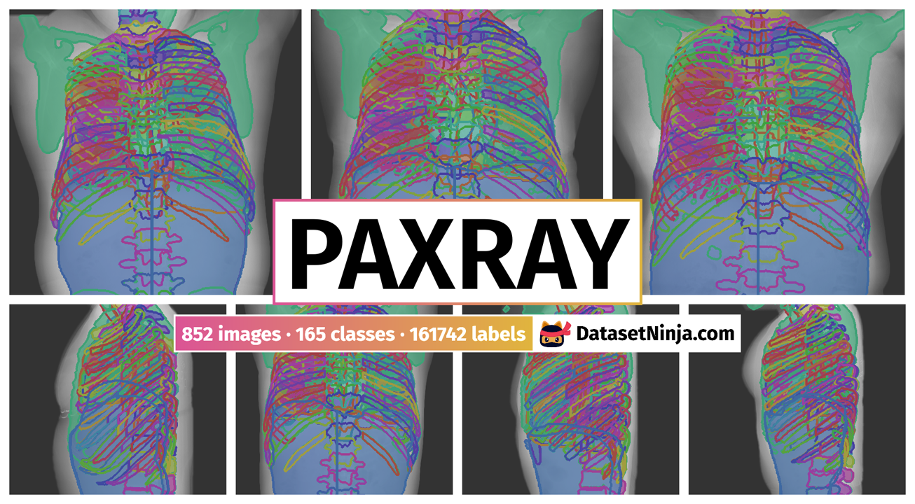 PAXRAY - Dataset Ninja
