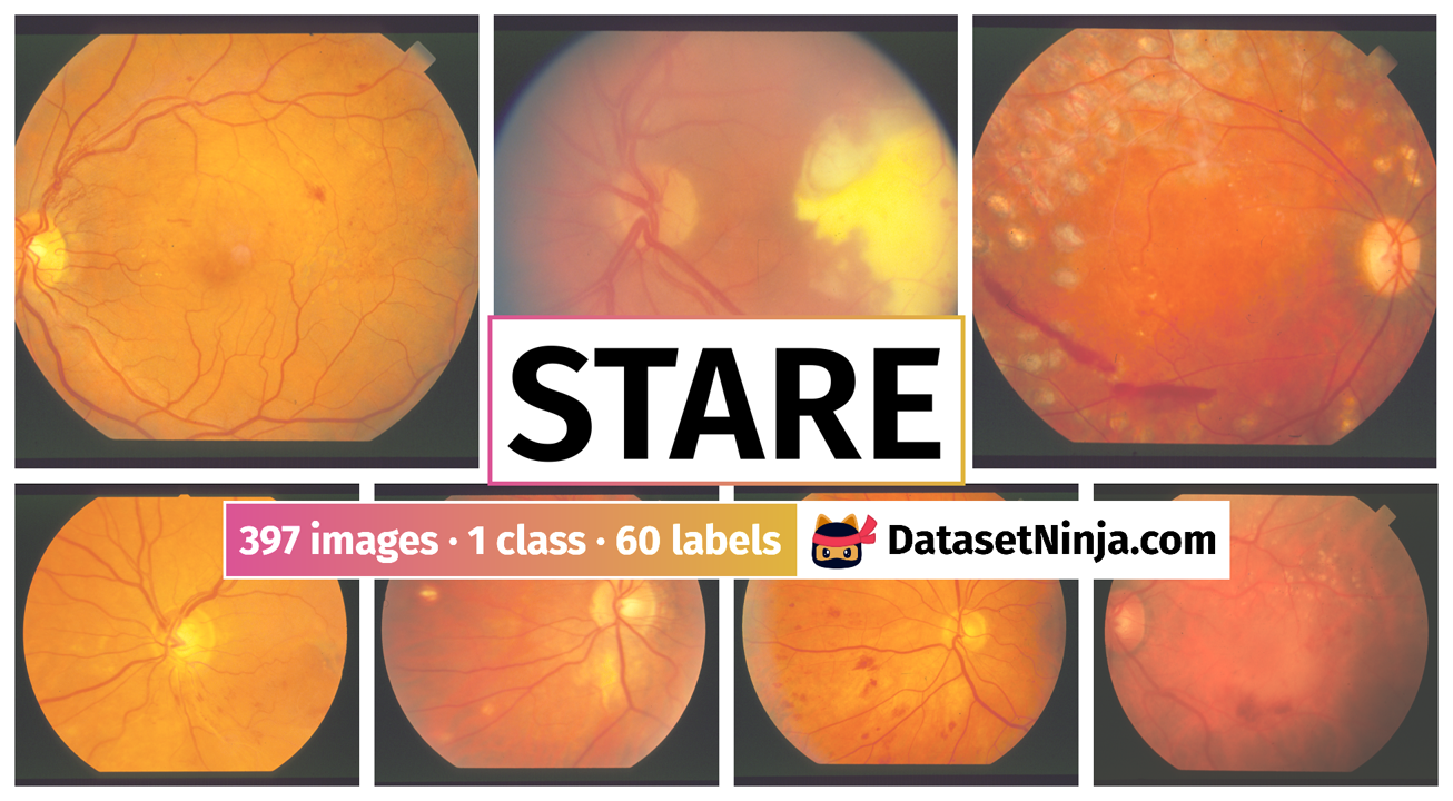 STARE - Dataset Ninja