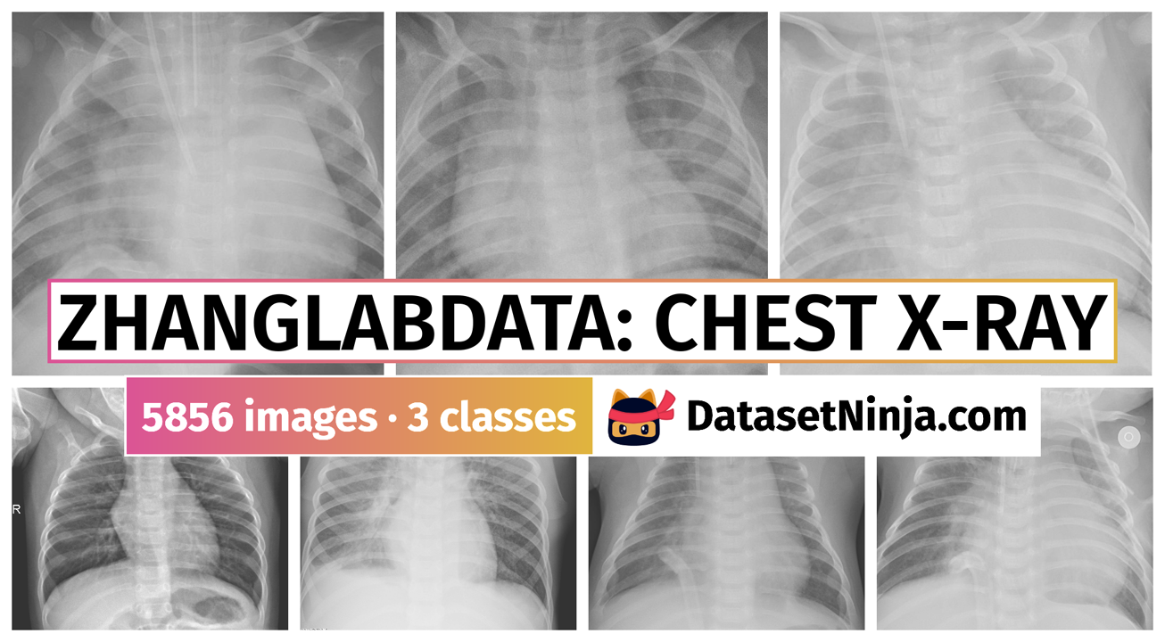Zhanglabdata Chest X Ray Dataset Ninja