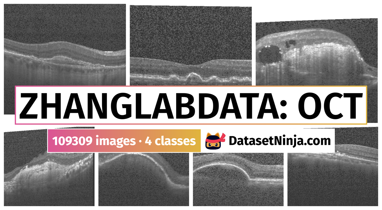 ZhangLabData: OCT - Dataset Ninja